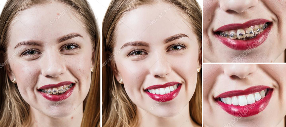 Gallery - Maidstone Dental