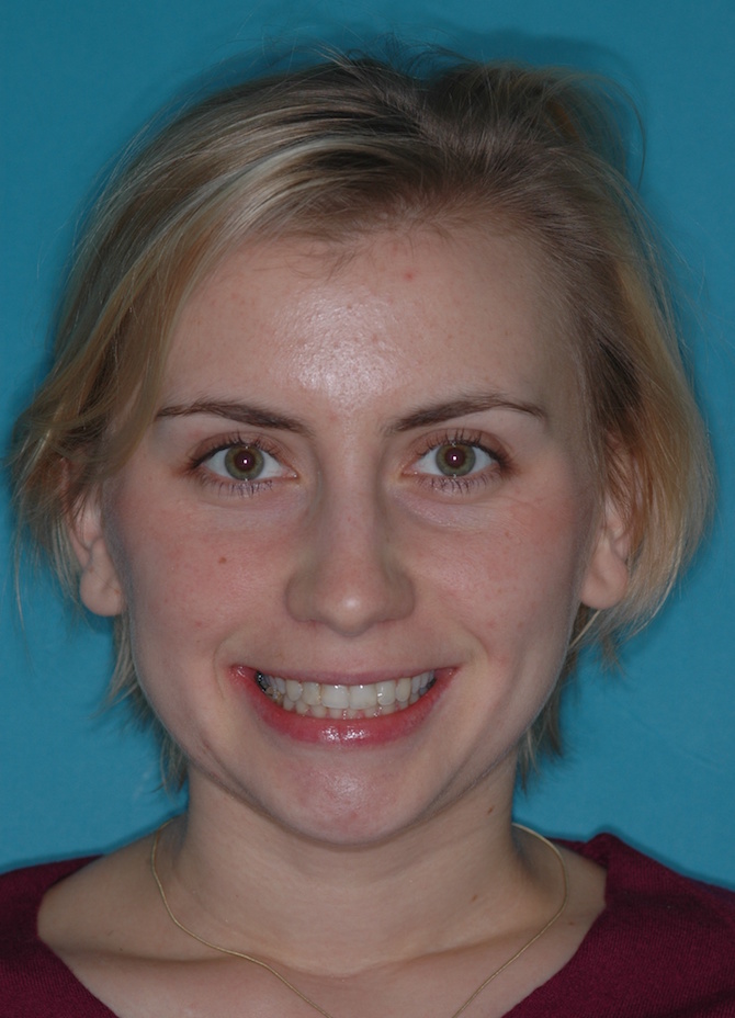 1-face - Maidstone Dental