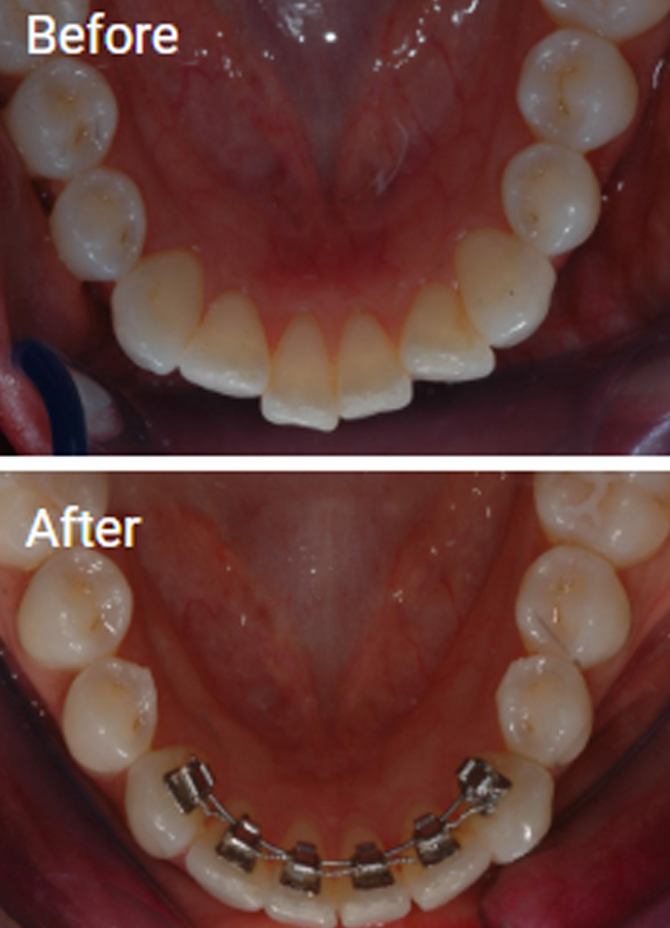 gallery2 [1] - Maidstone Dental